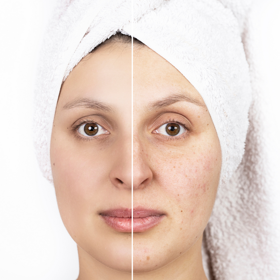 Healing Miracle Cream – Amour Skincare